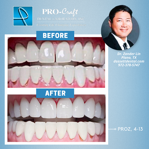 Patient Case Studies | PRO-Craft Dental Lab